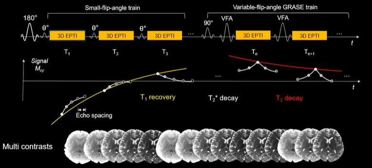 基于EPTI的运动伪影矫正
